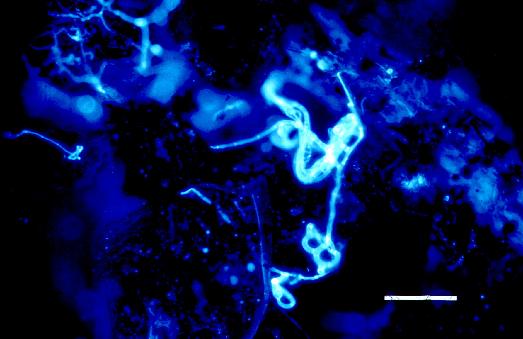 Fluorescence Microscopy for the Observation of Nematophagous Fungi ...